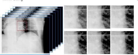 Figure 11 From Chapter 1 Markerless Tumor Gating And Tracking For Lung Cancer Radiotherapy