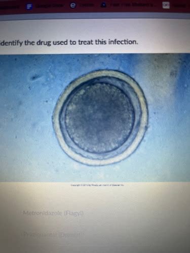 Parasitology Midterm Remediation Flashcards Quizlet