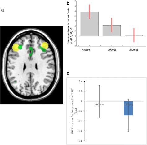 Showing Dot Task Fmri Results A Showing Brain Regions Where Activity Download Scientific
