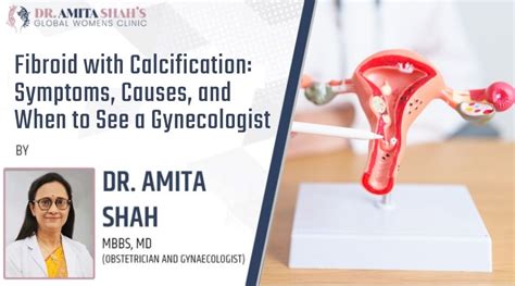 Fibroid With Calcification Symptoms Causes And When To See A Gynecologist