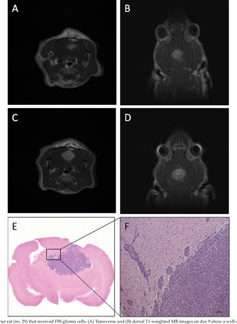 Figure 4 From Comparison Of Allogeneic And Syngeneic Rat Glioma Models