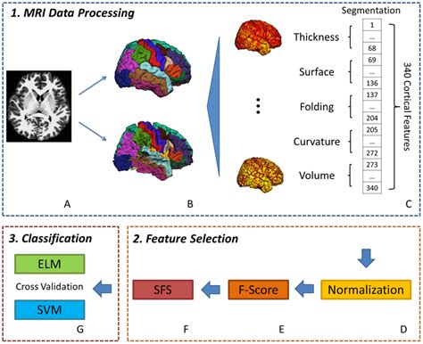 A Flowchart For Adhd Classification Using Human Cortical Feature