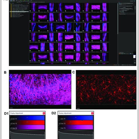Using Imaris Software To Identify The Morphometric Characteristics Of A