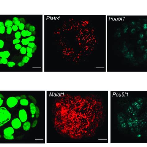 A Detection Of Multiple Rna Transcripts Such As Lncrna Platr4 Mrna