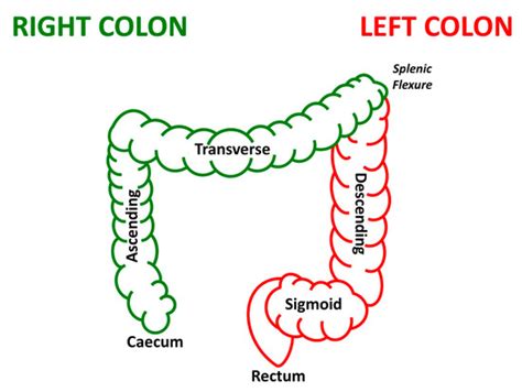 Proximal Vs Distal Colon