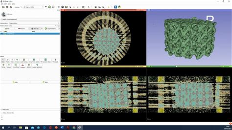 3d Slicer Ct Scan To Stl Youtube