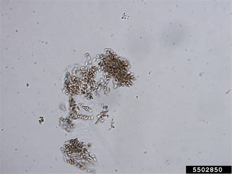 Fungus Genus Microsphaeropsis Höhn 1917
