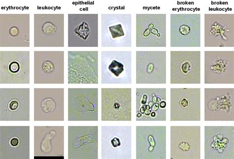 Figure 1 From Artificial Intelligence Analysis For Small Object Detection In Urine Sediment