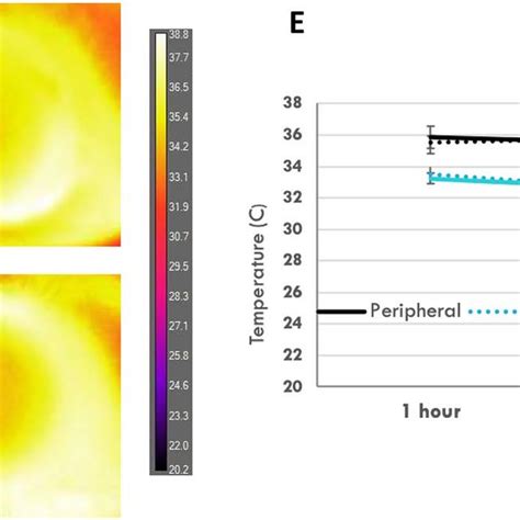 Representative Thermographic Maps Showing The Ocular Surface Download Scientific Diagram