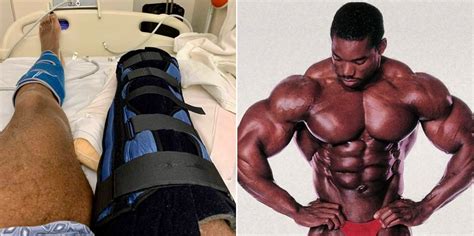 Flex Wheeler Gives Post Surgery Update Following Partial Leg Amputation Fitness Volt