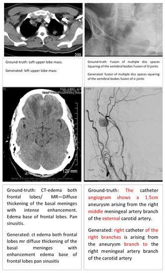 acapmed automatic captioning for medical imaging