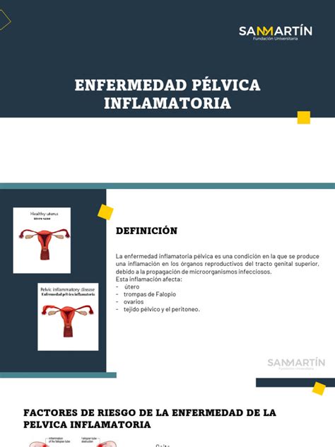 Enfermedad Pélvica Inflamatoria Guía Completa Pdf Inflamación