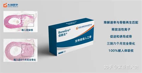 3证获批！羟基磷灰石能否迎来春天？ 知乎