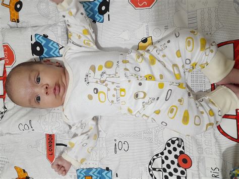 کبود شدن بیضه بعد از ختنه