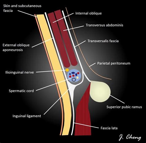Inguinal Canal Pacs
