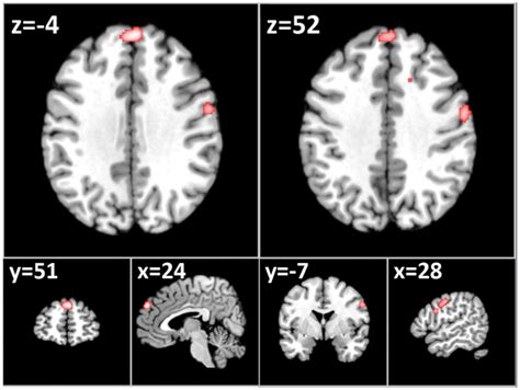 insular cortex fmri