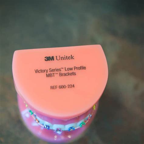 3m Advanced Metal Braces Larson Orthodontics In Alexandria Va