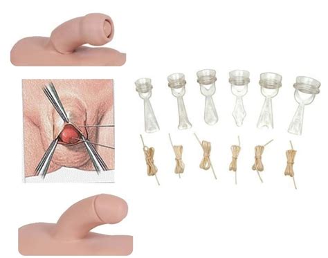Foreskin Removal Male Circumcision Health Benefits And Safety