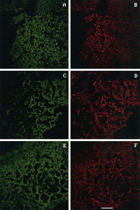 Tunel Assay To Detect Dna Fragmentation In Clone Ne 388 C Is A Section