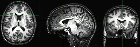 Afni Tutorial 3 Looking At The Data — Andys Brain Book 10 Documentation