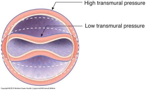 Venous Hemodynamics And Spectral Anaylsis Flashcards Quizlet