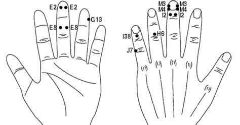 [유태우의 서금요법] 귀에 염증 생겼을 땐 항염·진통 치방을