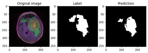 Github Ibrahimovnijatu Net Implementation Of 2d U Net Segmentation For Brain Mri Images