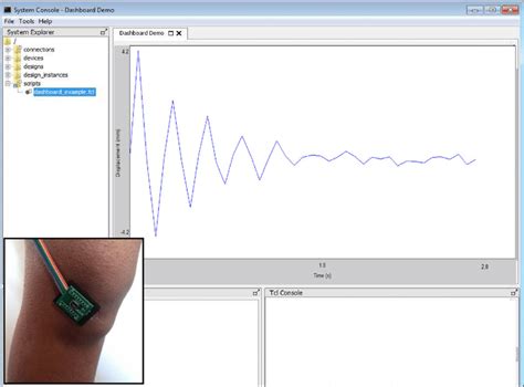 Placement Of The Accelerometer On The Skin At Left Bottom And Data Download Scientific