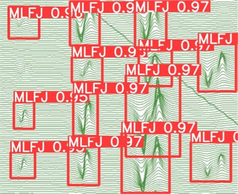 A Global Centralized Magnetic Flux Leakage Small Defect Detection