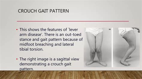 neurological gait rehabilitation ppt