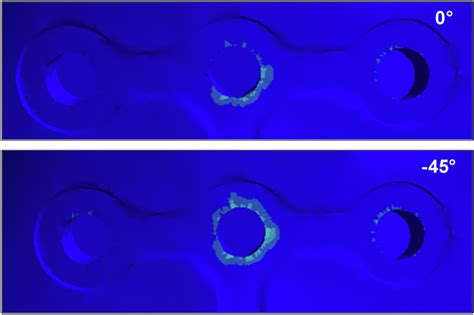 Finite Element Analysis Of A Newly Designed Miniplate For Orthodontic Anchorage In The Maxillary