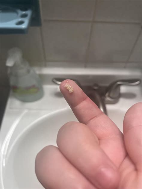 Tiny Stones Rtonsilstones