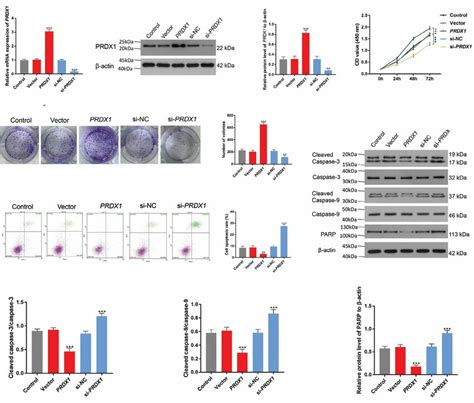 Prdx1 Knock Down Induced Cell Death Via Apoptosis In Hcc Cells A