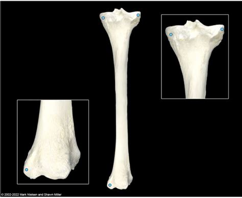 Tibia Posterior View Diagram Quizlet