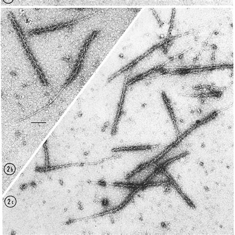 Electron Micrographs Of Actin Filaments Negatively Stained With 1