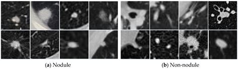 Multi Scale Heterogeneous 3d Cnn For False Positive Reduction In Pulmonary Nodule Detection