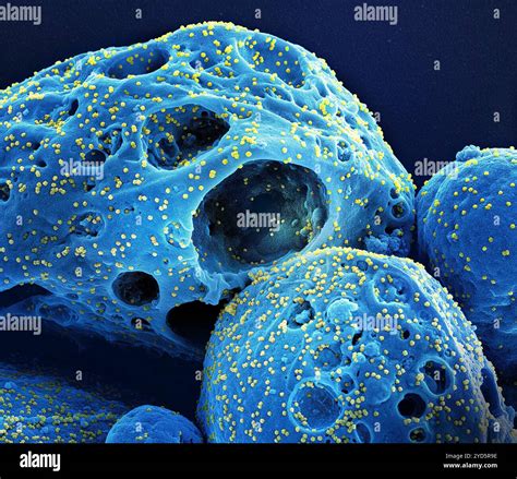 Colorized Scanning Electron Micrograph Of A Cell Blue Infected With The Omicron Strain Of Sars