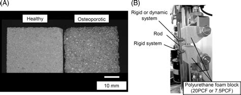 A Picture Of The Polyurethane Foam Blocks Replicating Healthy And Download Scientific Diagram