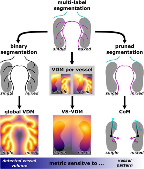 vdm workflow simplified pipeline and metrics overview hippocampal