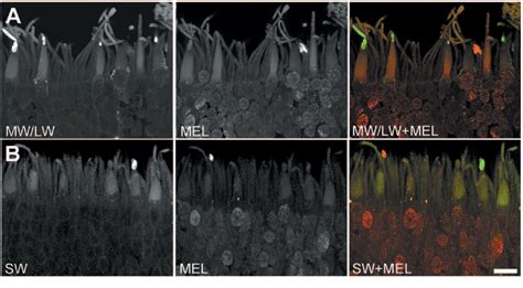 Figure 3 From Immunohistochemical Evidence Of A Melanopsin Cone In Human Retina Semantic Scholar