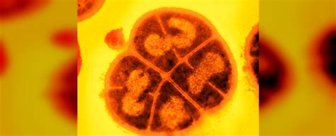 Deinococcus Radiodurans Structural Characterization And Functional