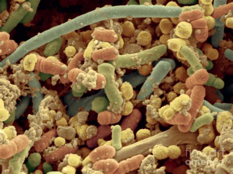Streptococcus Pyogenes Photograph By Scimat Pixels