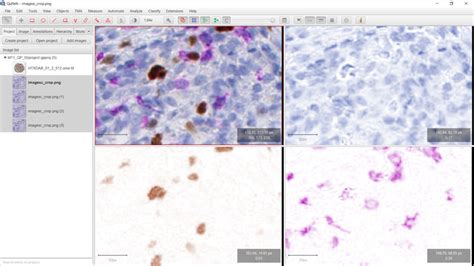 ᴗ qupath scripting 6 customized 3 stain color deconvolution