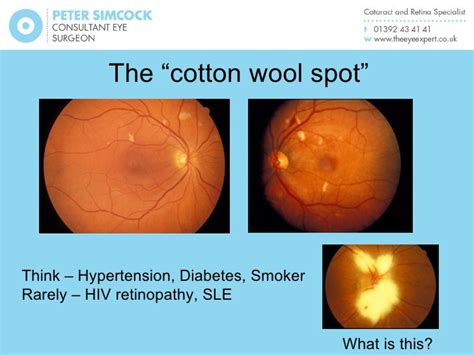A Macular Pathology And Oct Update For Optometrists