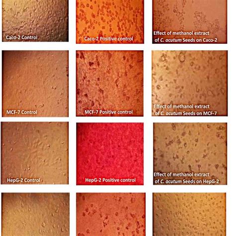 Hplc Mobile Phase Gradient Method For Phenolic Acids Separation Download Scientific Diagram