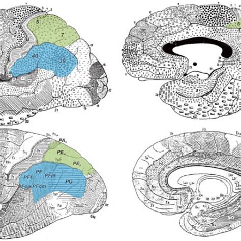 Pdf The Precuneal Cortex Anatomy And Seizure Semiology