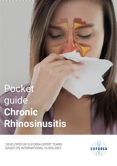 How To Perform Strep Throat Swab