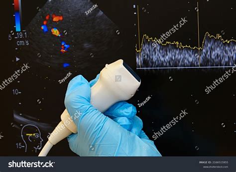 Transcranial Doppler Worksheet