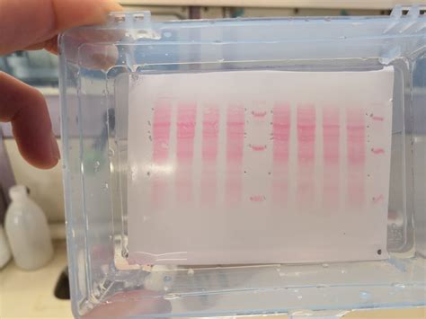 Western Blot Transfer Problem What Could Cause It Researchgate