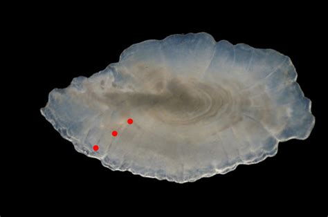 Sagittal Otolith From A 3 Year Old Male Tl 17 2 Cm Pagellus Acarne Download Scientific